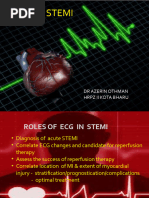 12 Lead ECG Analysis For STEMI (1) - Tagged | PDF | Electrocardiography | Visual Cortex