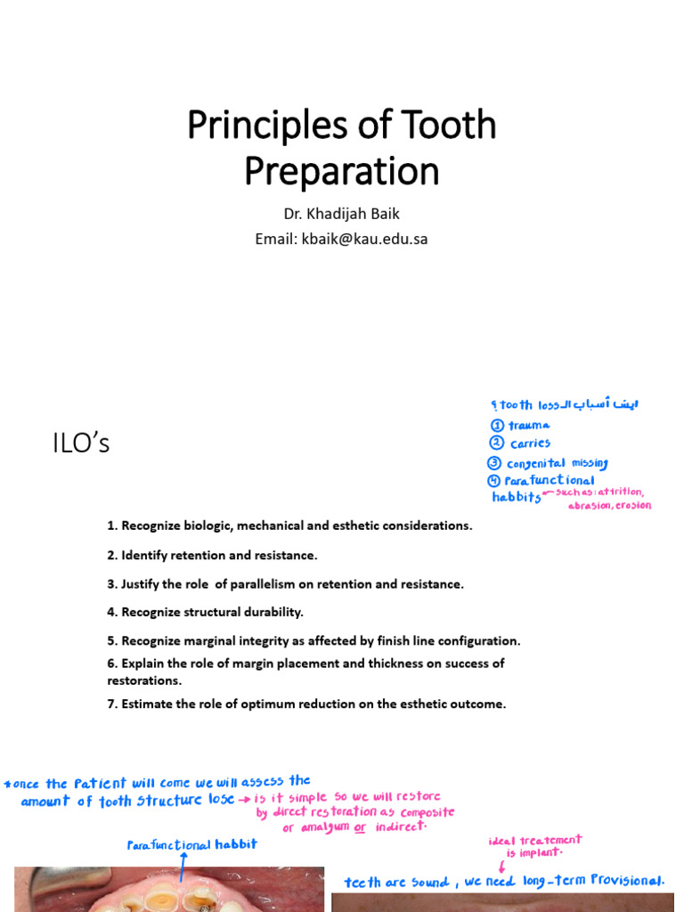 3-4- Principles of Tooth Preparation 20-21 | PDF | Human Tooth ...