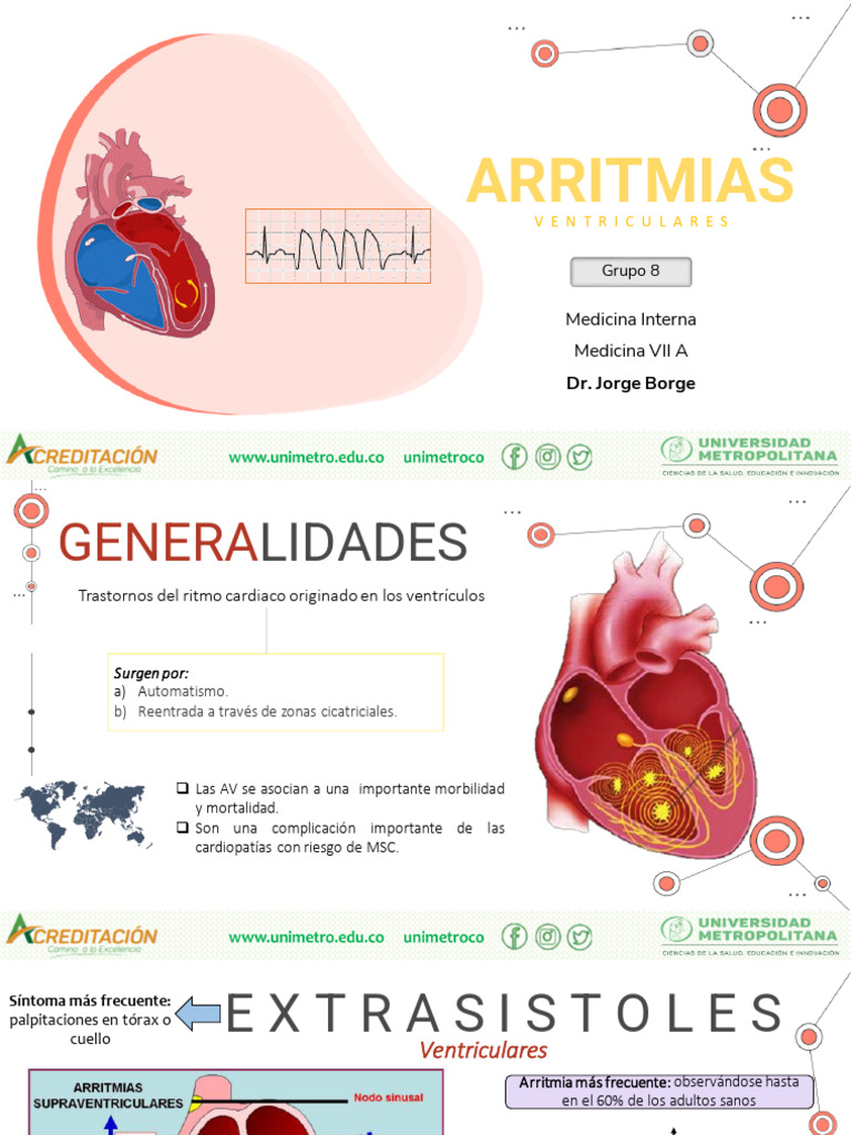 Arritmias Ventriculares | PDF | Electrocardiografia | Causas de la muerte