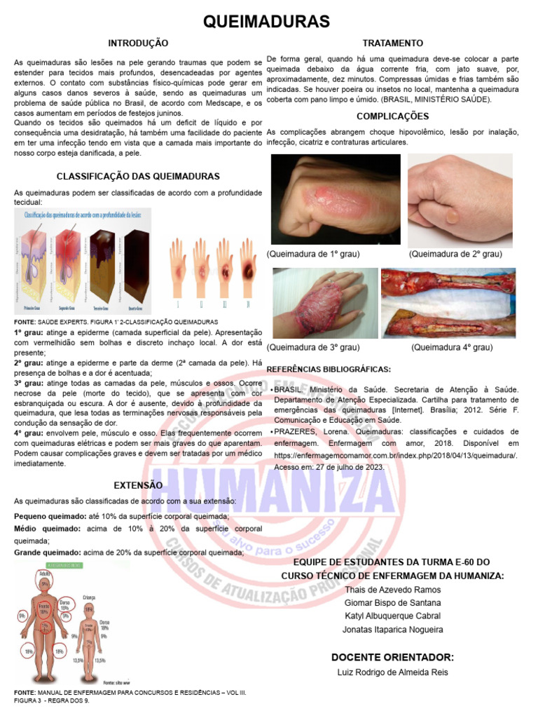 Diagrama De Queimadura De Primeiro Grau Queimaduras: Classificações