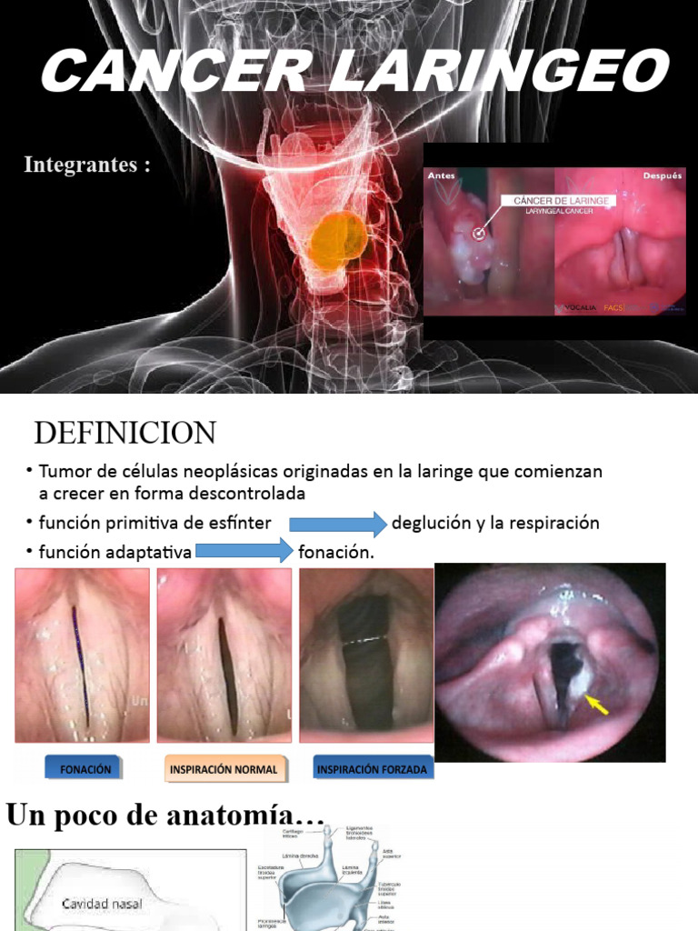Ca Laringeo | PDF | Cáncer | Enfermedades y trastornos humanos