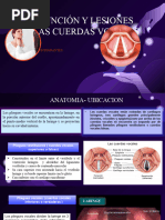 Nódulos y Pólipos Laríngeos: Guía Completa | PDF | Laringe | Anatomía ...