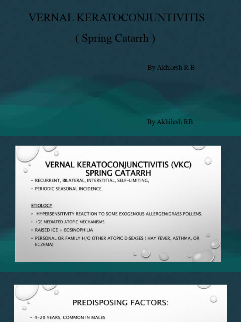 Vernal Keratoconjuntivitis (Spring Catarrh) : by Akhilesh R B | PDF