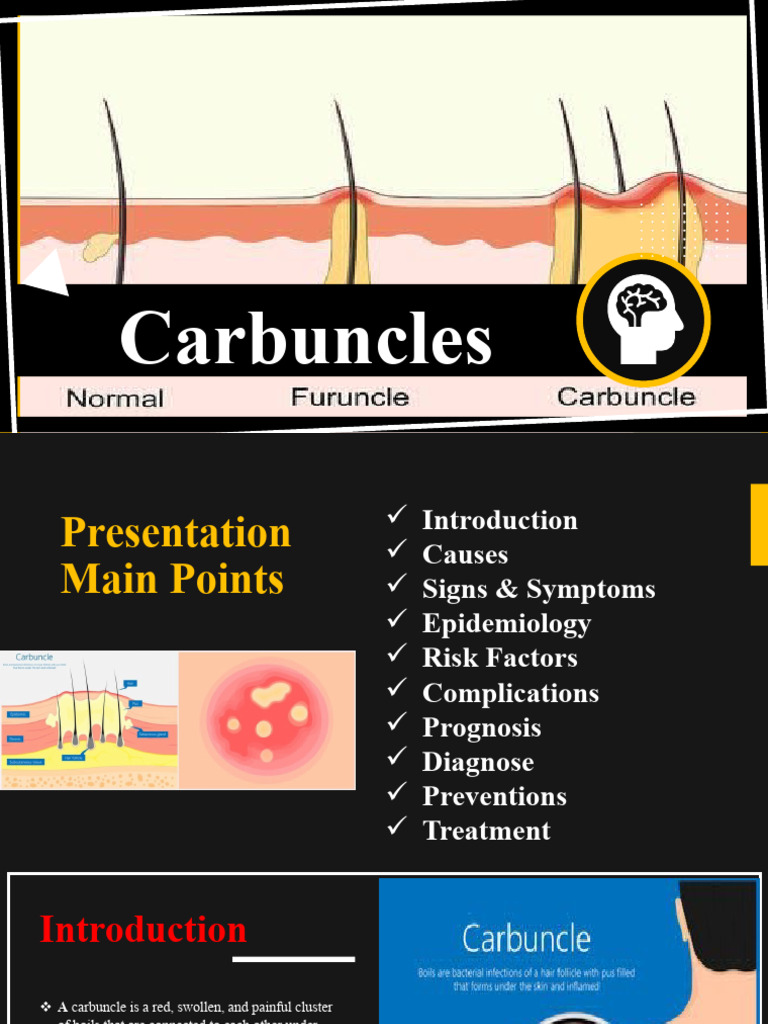 Carbuncles | PDF | Medical Specialties | Diseases And Disorders