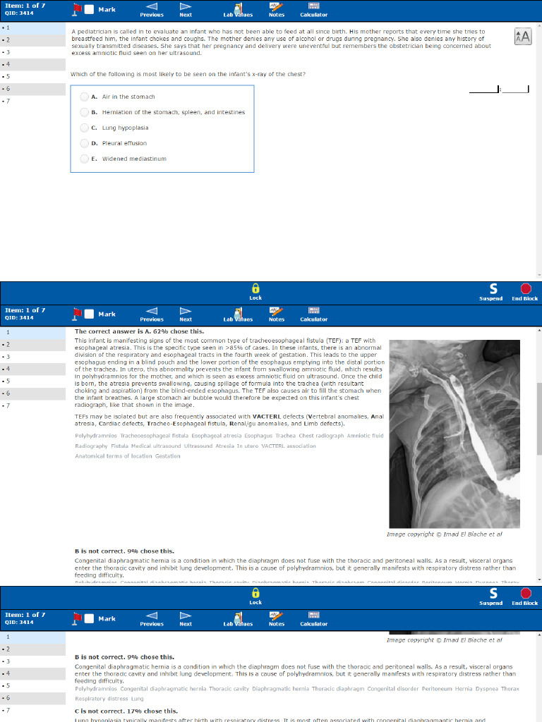 Usmle RX Qbank 2017 Step 1 Gastroenterology Embryology | PDF ...