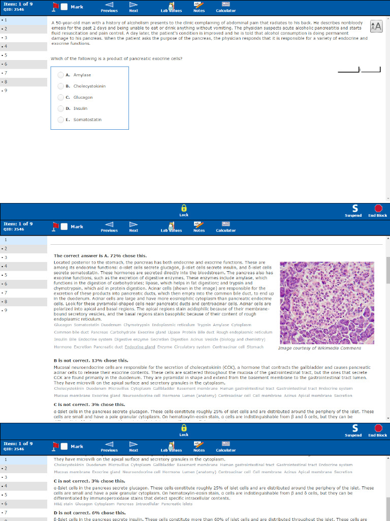 Usmle RX Qbank 2017 Step 1 Gastroenterology Histology | PDF | Pancreas | Ulcerative Colitis