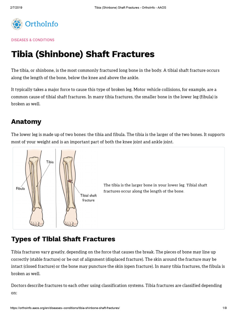 Tibia (Shinbone) Shaft Fractures - OrthoInfo - AAOS | PDF | Surgery ...