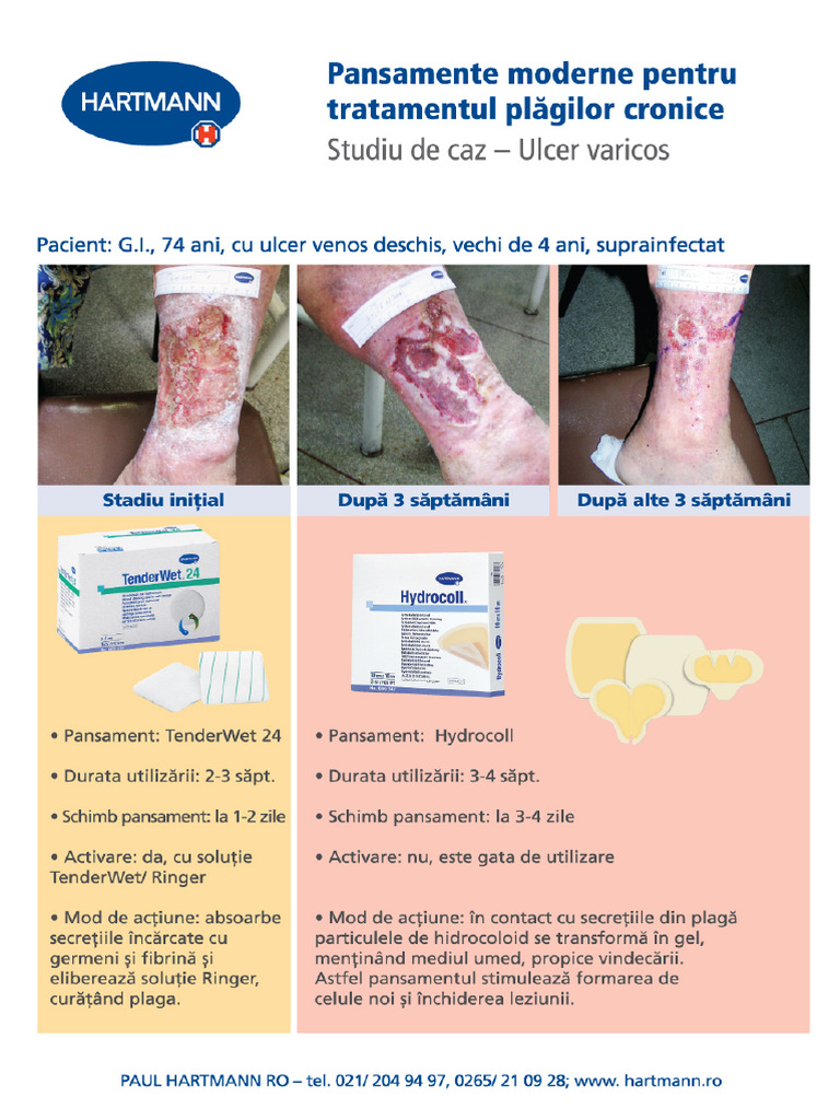 Studiu de Caz - Ulcer Varicos | PDF