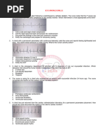 ECG - EKG Practice Quiz (Identify Rhythms) | PDF | Electrocardiography ...
