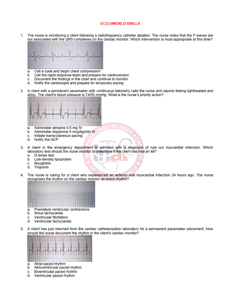 ECG Uworld | PDF | Artificial Cardiac Pacemaker | Heart