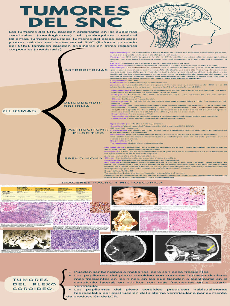 tumores del snc infografia | PDF | Glioma | Sistema nervioso central