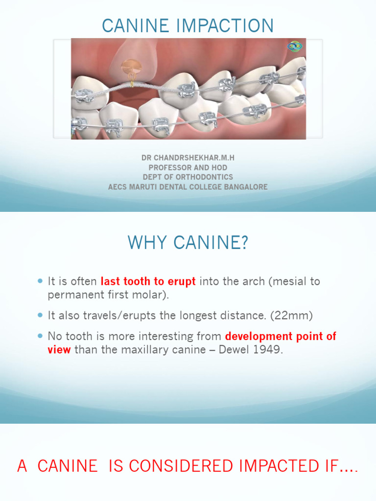 Canine Impaction Final PDF | PDF | Dental Anatomy | Dentistry