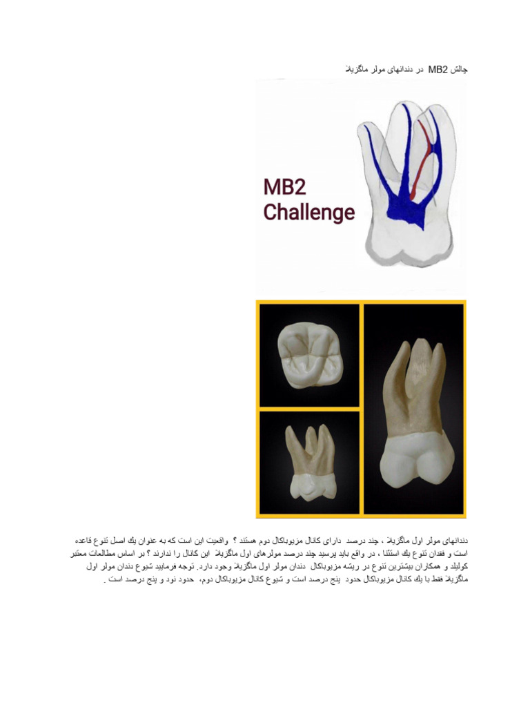 ENDOBOOK MB2 کانال | PDF