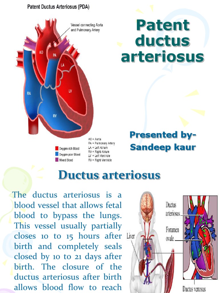 Pda | PDF | Ventricle (Heart) | Heart