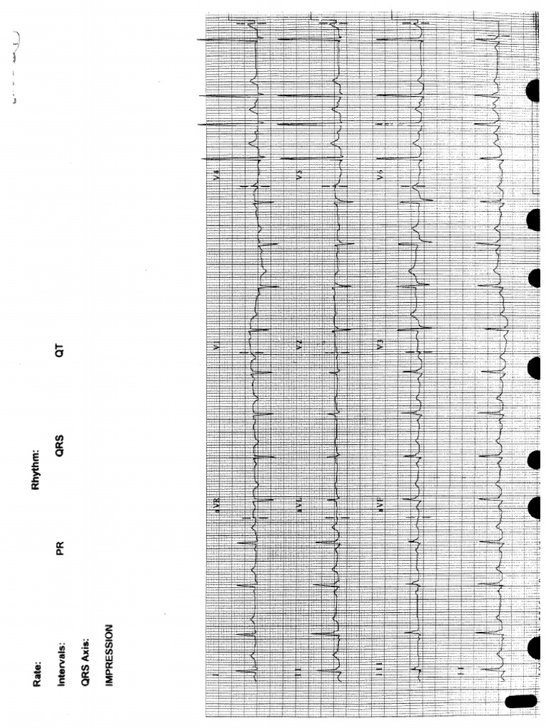 Ekg 2 - Handout | PDF
