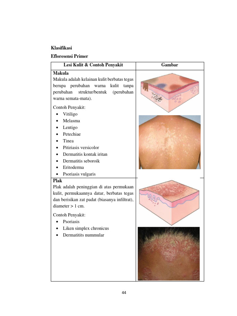 Efloresensi Kulit | PDF