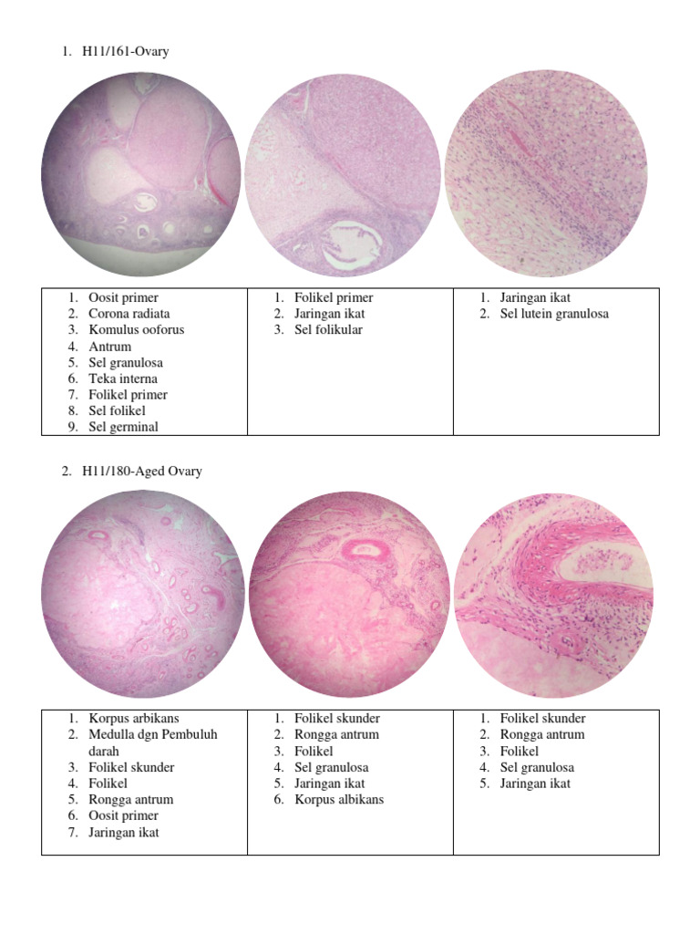 Histologi Ovarium dan Folikel Sel | PDF | Kesehatan Holistik