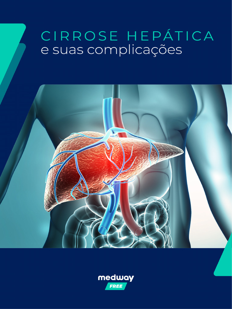 Manejo da Cirrose Hepática e Complicações | PDF | Fígado | Cirrose