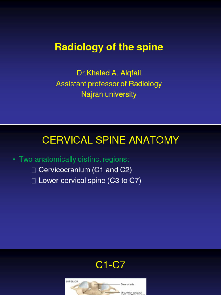Radiology of The Spine | PDF | Vertebra | Vertebral Column