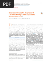 Ecg Interpretation J Point Stemi Criteria Equivalents and Others | PDF ...