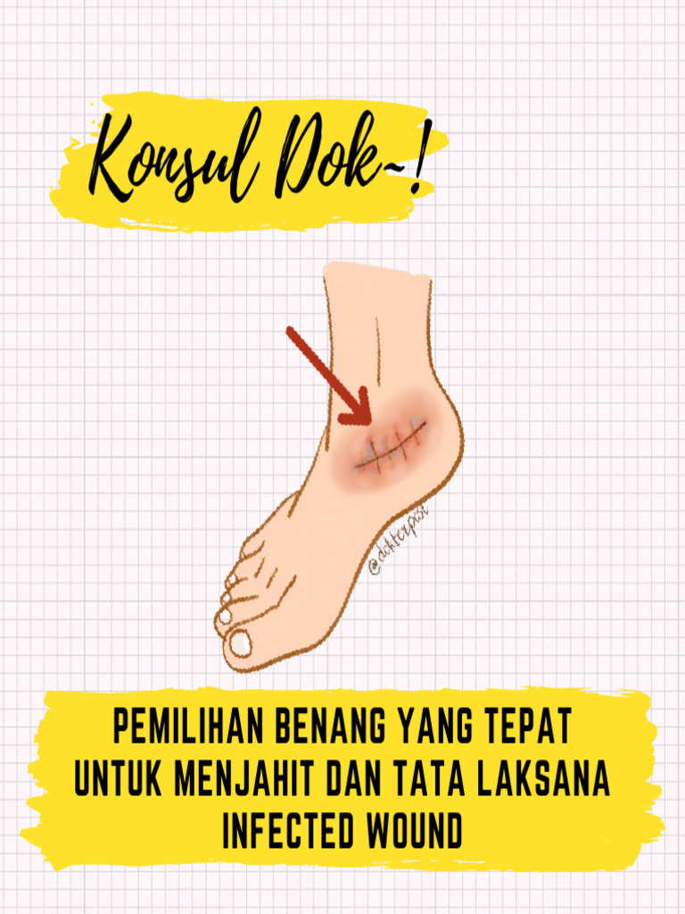 Pemilihan Benang untuk Jahit Luka Infeksi | PDF | Kesehatan Holistik | Sains & Matematika