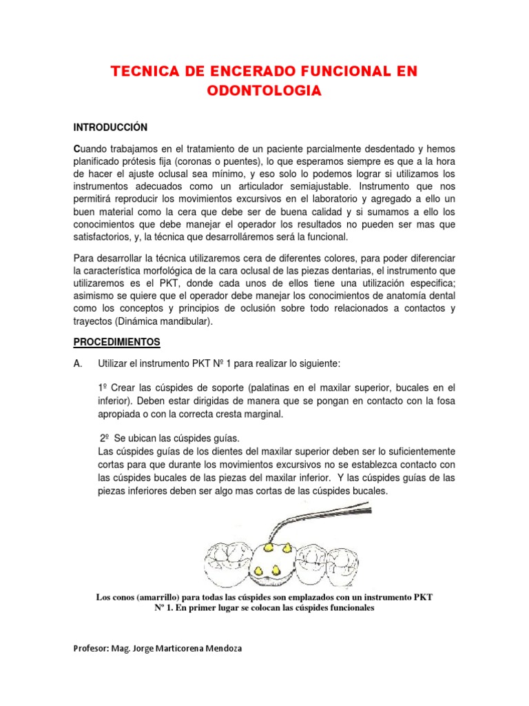 Tecnica de Encerado Funcional en Odontologia | PDF | Dentadura postiza | Bienestar