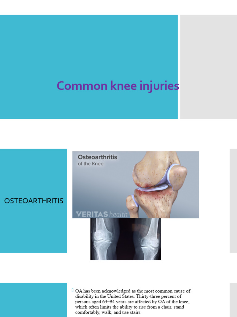 Common Knee Injuries By DR.DANISH MALIK | PDF | Knee | Musculoskeletal ...