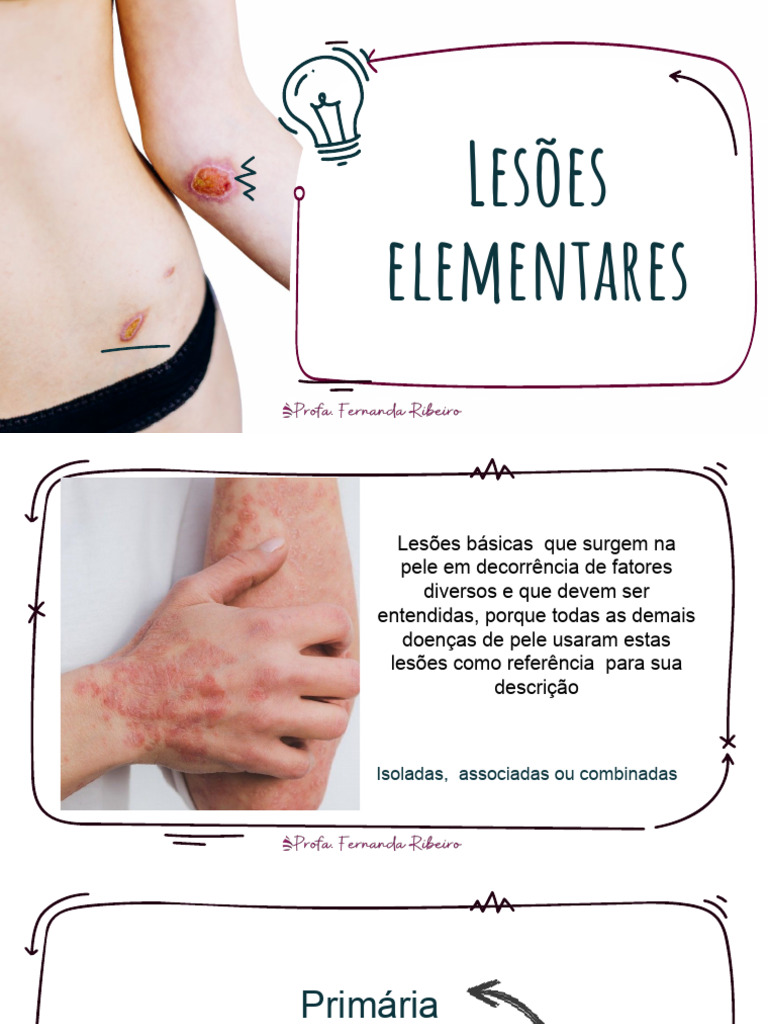 Aula 06 Dermatologia-Lesões Elementares | PDF | Pele | Edema