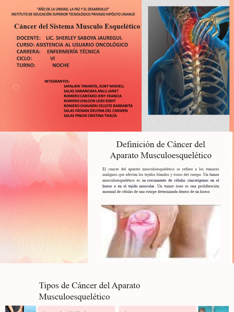 Cáncer del Sistema Musculoesquelético | PDF | Cáncer | Hueso