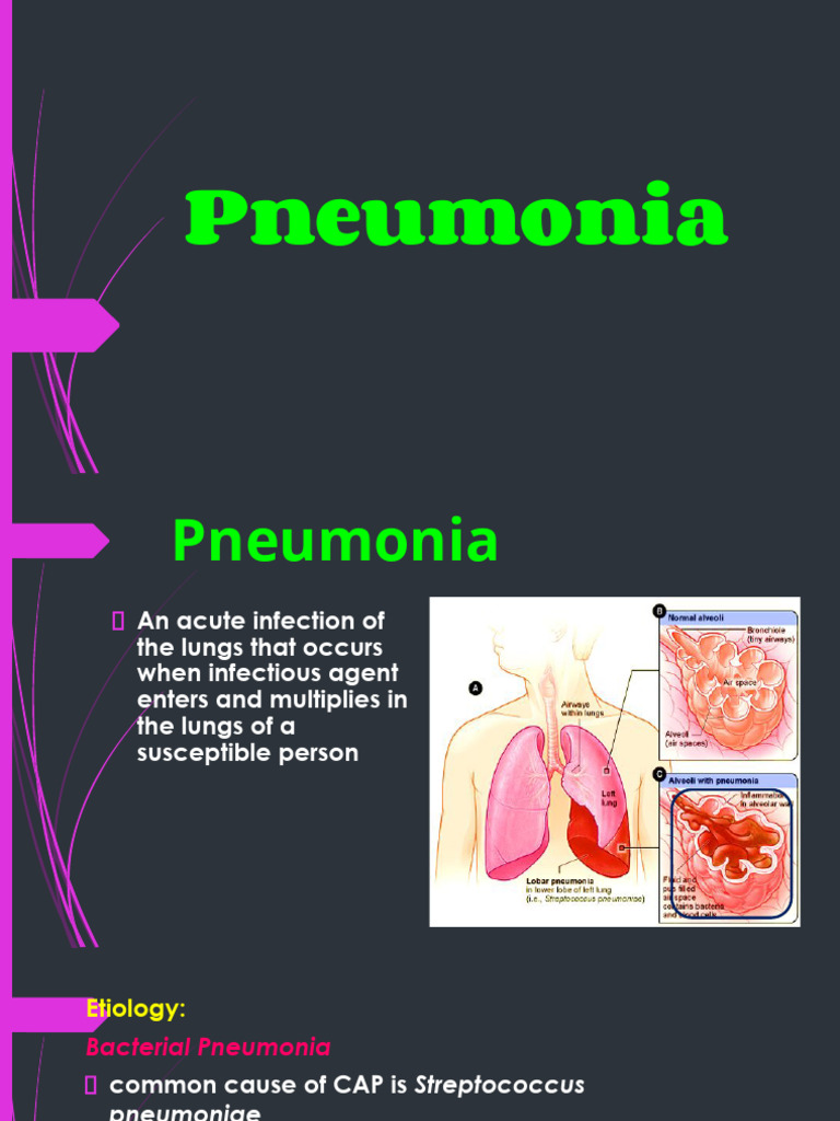 PNEUMONIA | PDF | Pneumonia | Cough