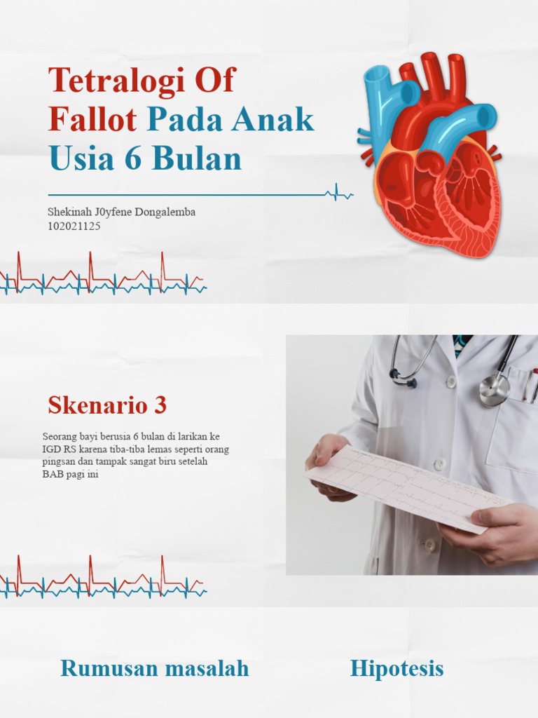 Tetralogy of Fallot | PDF