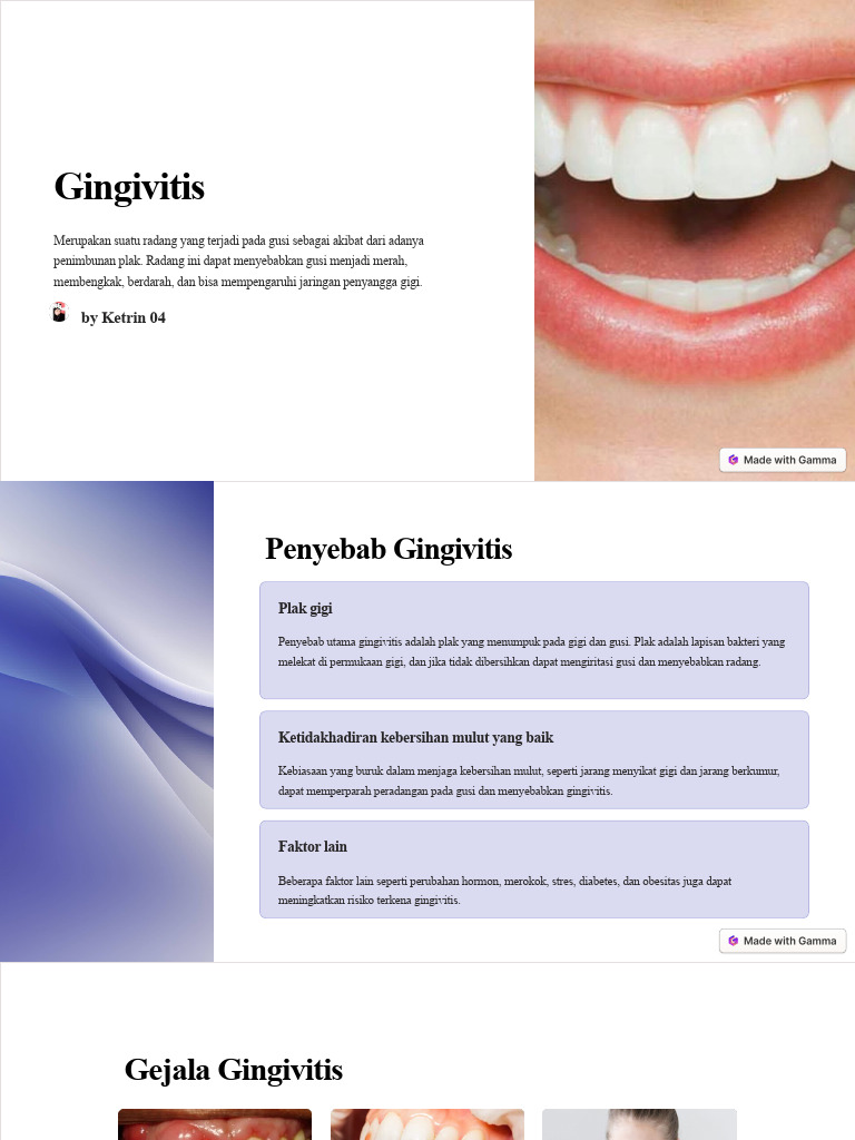 Gingivitis | PDF