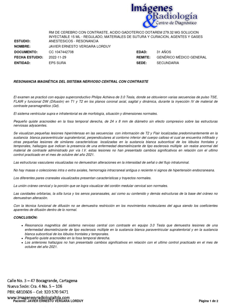 RM DE CEREBRO CON CONTRASTE, | PDF | Esclerosis múltiple | Imagen de ...