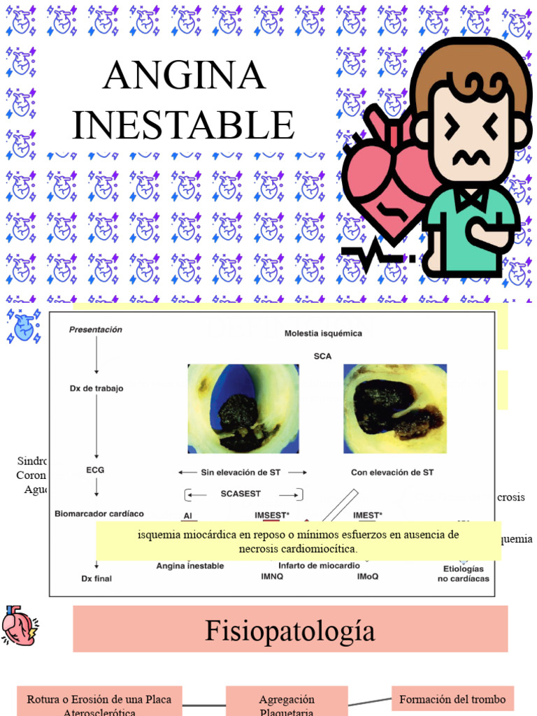 Angina Inestable | PDF | Infarto de miocardio | Medicina CLINICA