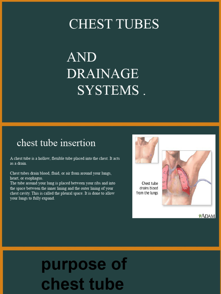 Chest Tubes | PDF