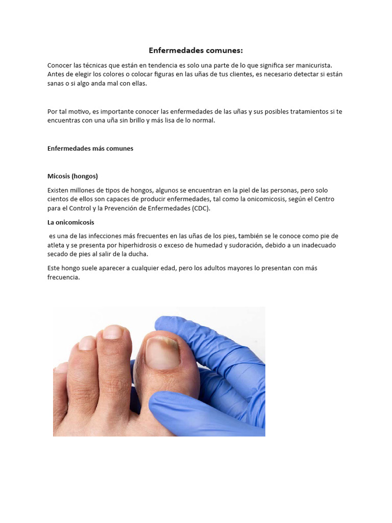 Moho y onicolisis en uñas acrílicas | PDF | Clavo (anatomía) | Epidermis