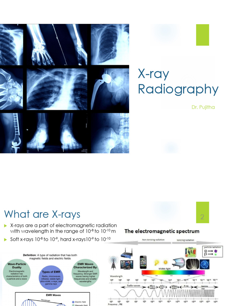 X-Ray Radiography | PDF | X Ray | Electromagnetic Radiation