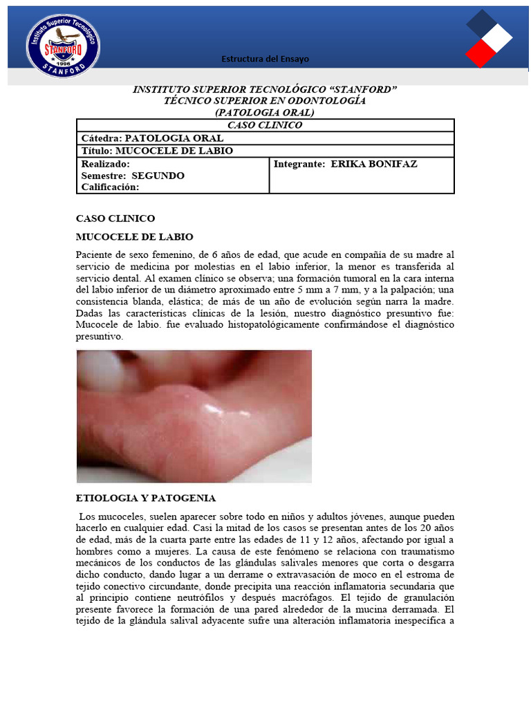 Mucocele de Labio en Niños | PDF | Salud y bienestar | Ciencia y ...
