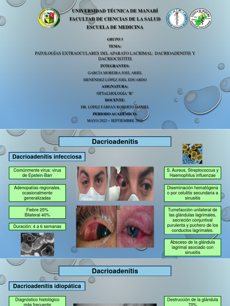 Dacrioadenitis y Dacriocistitis: Patologías | PDF | Inflamación ...