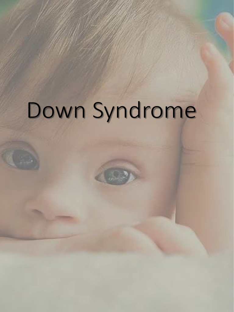 Down Syndrome | PDF | Down Syndrome | Genetics
