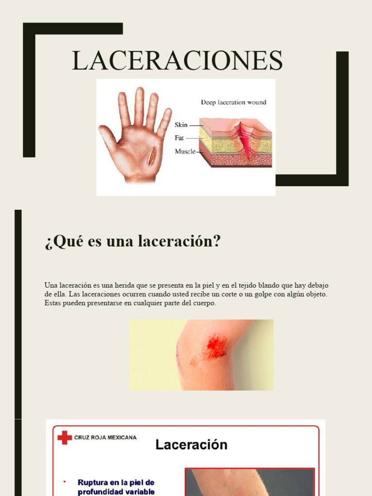 LACERACIONES | PDF | Herida | Medicina