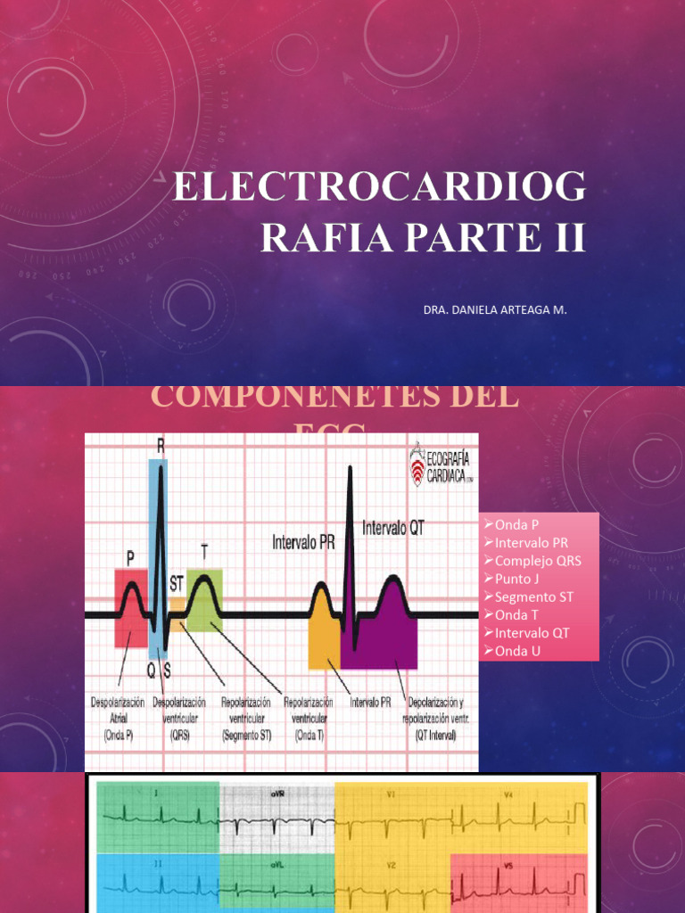 Componentes y Análisis del ECG | PDF | Electrocardiografia ...