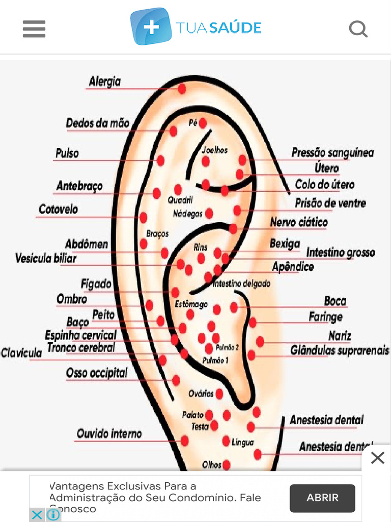 Auriculoterapia o Que É, Como É Feita e Principais Pontos - Tua Saúde | PDF