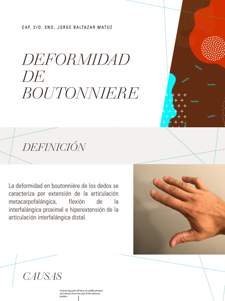 Deformidad de Boutonniere | PDF | Causas de la muerte | Articulaciones