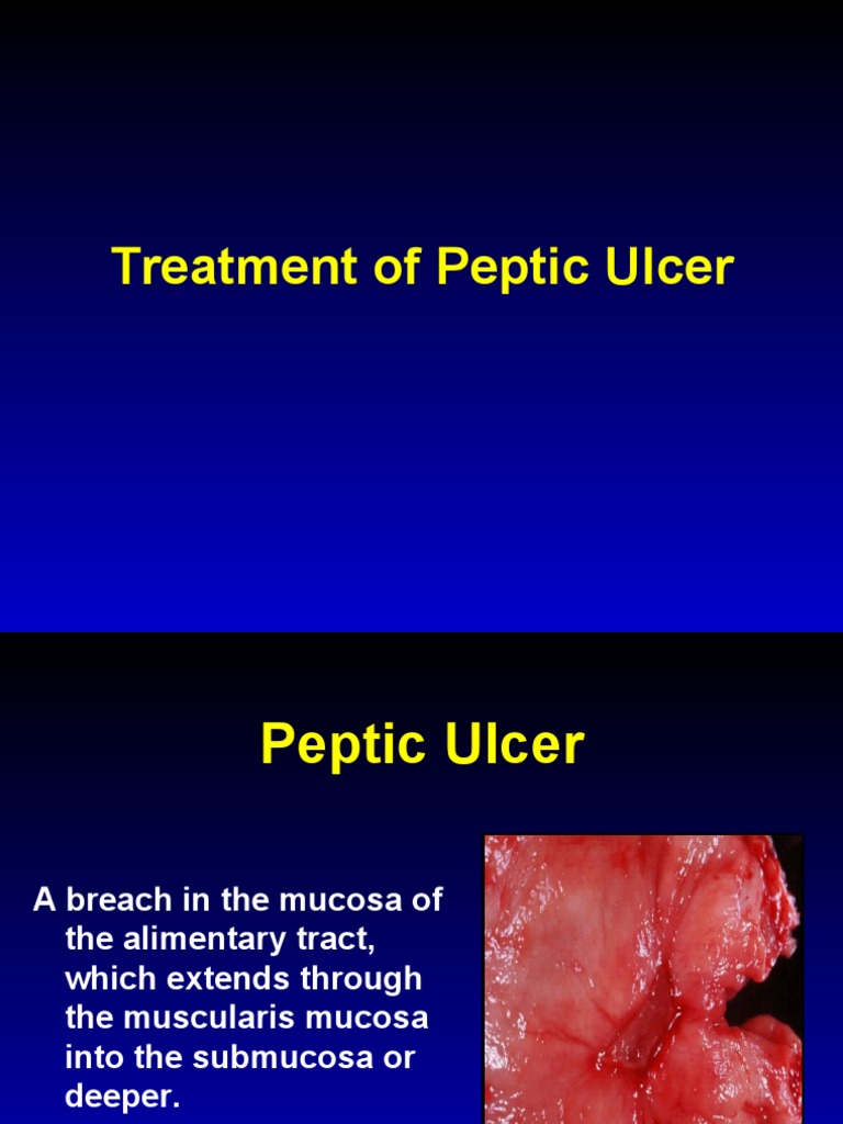 Treatment of Peptic Ulcer | PDF | Pharmacology | Drugs