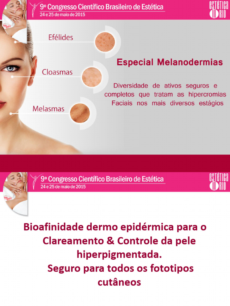 Especial Melanodermias Diversidade de Ativos Seguros e Completos Que Tratam As Hipercromias ...