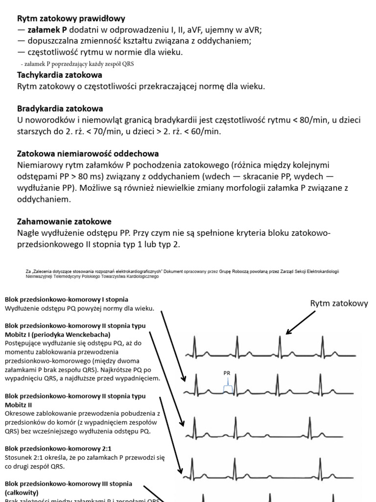 2023 Ekg Cale Wazne Skrot | PDF