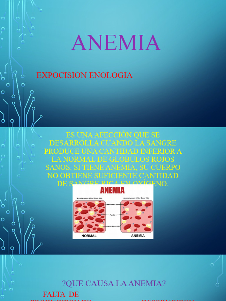 ANEMIA Presentacion | PDF | Anemia | Panes