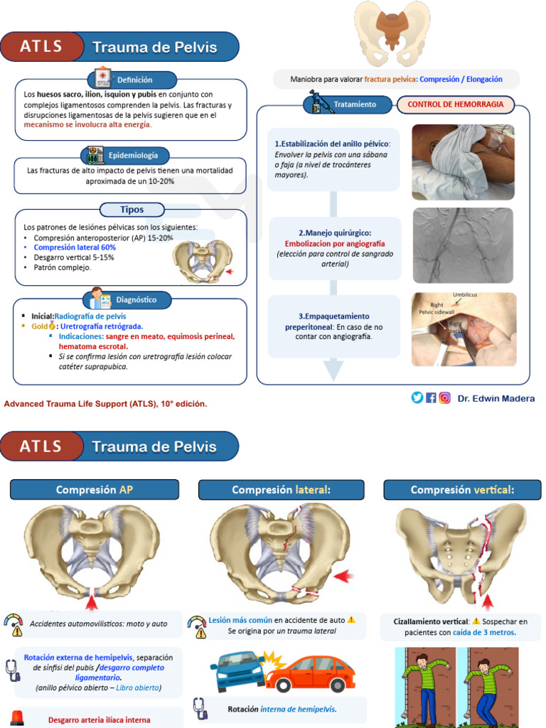 Lesiones y Manejo del Trauma Pélvico | PDF | Pelvis | Lesión