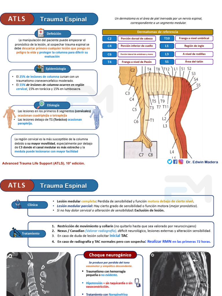 Trauma Espinal | PDF | Lesión de la médula espinal | Médula espinal